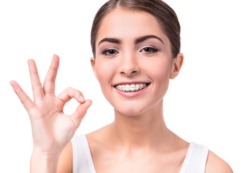Clear Braces vs. Metal Braces – Knollwood Dental Care